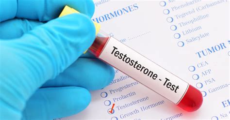 Understanding Testosterone Test Results What You Need To Know