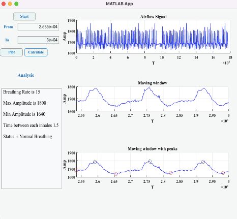 User Interface With Results Of Airflow Signal With Normal Breathing Segment Download
