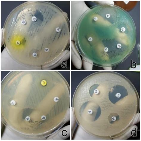 Antibiotic Sensitivity Test Abst A Enterococcus B Pseudomonas Download Scientific Diagram