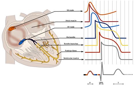Electrocardiogram