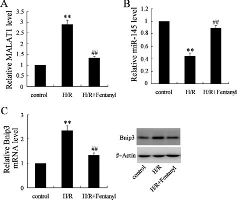Figure 1 From Long Non Coding Rna Malat 1 Functions As A Mediator In