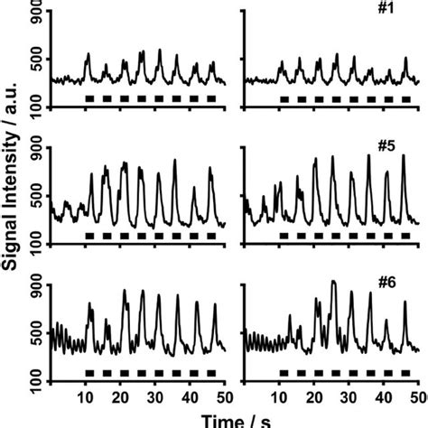 Regions Of Interest In The CSF Ventricular System Sagittal A And Download Scientific Diagram