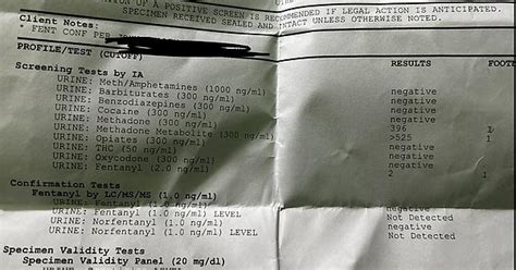 Ua Example Album On Imgur