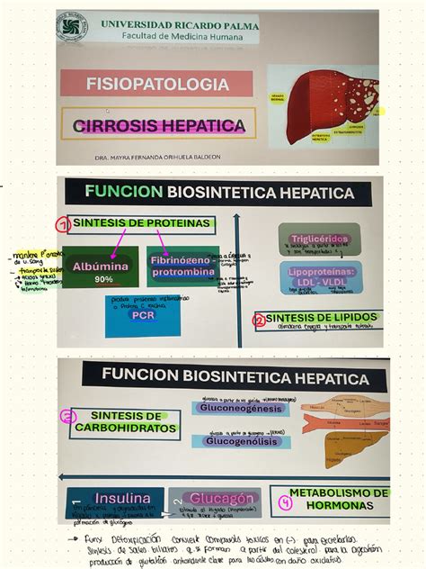 6 Cirrosis Hepatica Pdf