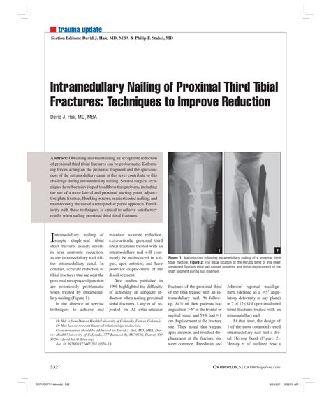 Pdf Intramedullary Nailing Of Proximal Third Tibial Fractures Techniques To Improve Reduction