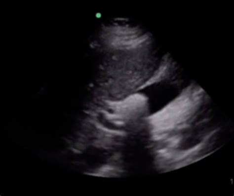Ultrasound Leadership Academy Ruq Ultrasound — Em Curious