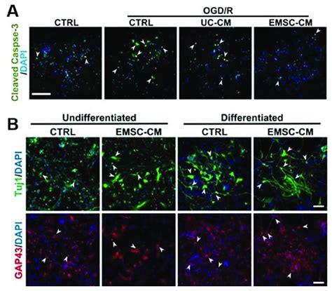 A Primary Cultures Of Rat Cortical Neurons Were Exposed To Ogdr In
