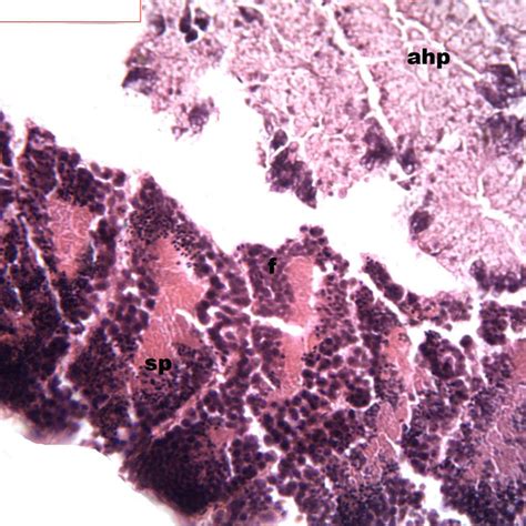 Stages Of Spermatogenesis Maturation Of The Germinal Sexual Cells In Download Scientific