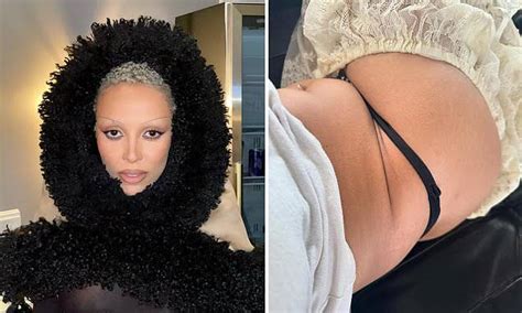 Singer Doja Cat Laments That Her Brazilian Butt Lift Has Gone Out Of