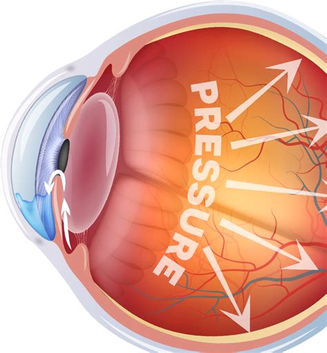 Glaucoma Testing Detroit Mi Byrd Eye Clinic