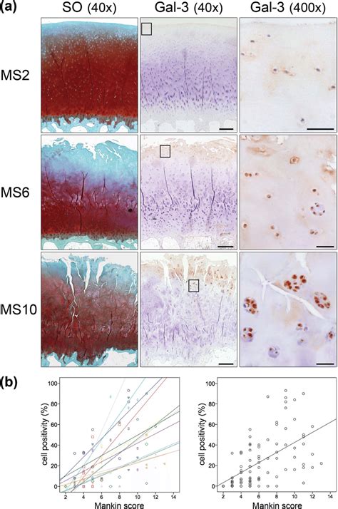 Gal 3 Presence In Articular Chondrocytes Correlates With Cartilage