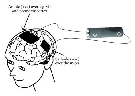 A A Novel Bihemispheric Tdcs Montage Targeting Right And Left Lower Download Scientific