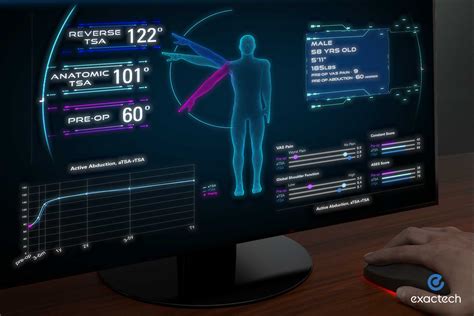 Press Releases And News Exactech