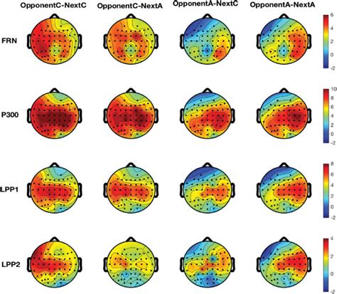 The Corresponding Scalp Topographies Of Each Conventionally Averaged