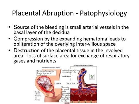 Ppt Thi Rd Trimester Bleeding And Management Powerpoint Presentation