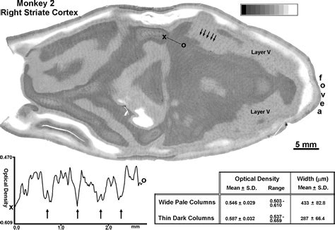 Monocular Core Zones And Binocular Border Strips In Primate Striate Cortex Revealed By The