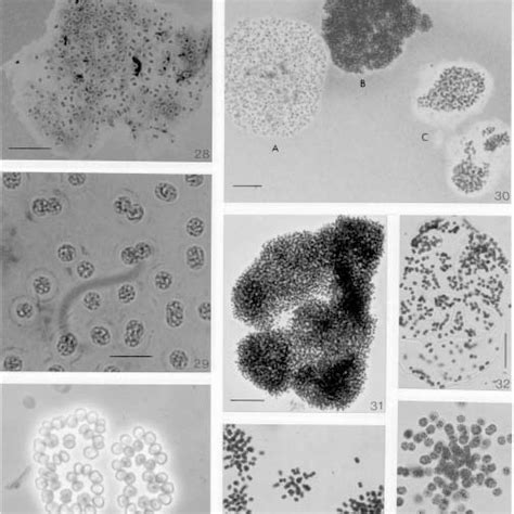 Chroococcales Species From São Paulo State 1 Chroococcus Dispersus Download Scientific