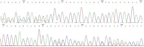 electropherogram of the mutation in patient no 1 download