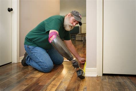 Partial Hand Limb Differences Through The Palm