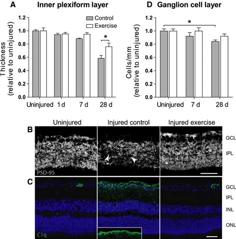 Exercise Prevents Inner Retinal Synaptic Loss And Complement Deposition