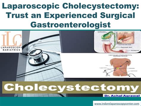 Laparoscopic Cholecystectomy Trust An Experienced Surgical Gastroenterologist By Indore
