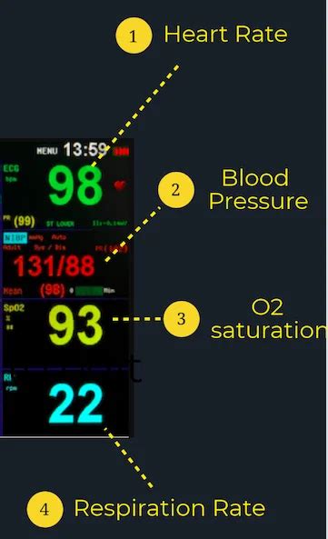 Ekg Monitor Screen