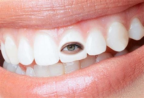 Surgery Implants Tooth Into Eyeball To Help Blind Patients See Again