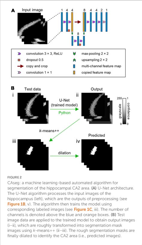 Figure 2 From Machine Learning Based Segmentation Of The Rodent Hippocampal Ca2 Area From Nissl