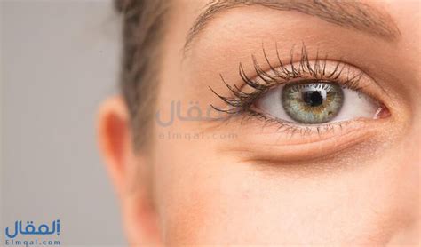 انتفاخ العينين الأسباب التي تؤدي إلى تورم العين وعلاجه ومتى يجب