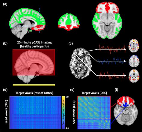 Study Overview A Orbitofrontal Cortex OFC Red And Wholebrain Download Scientific Diagram