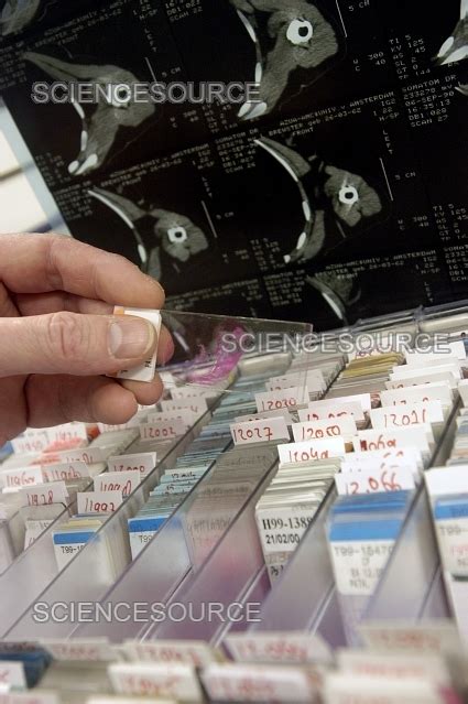 Histology Microscope Slides Stock Image Science Source Images
