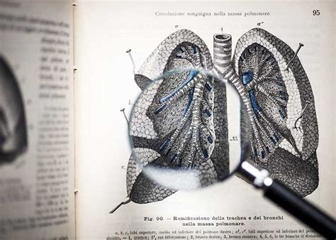 Weinig Therapietrouw Bij Gebruik Labaics Doq