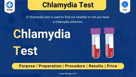 chlamydia test purpose price and results drlogy