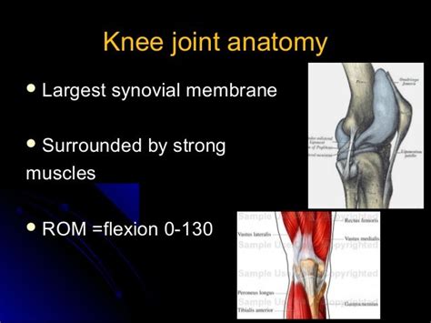 Knee Arthrocentesis