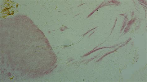 Image Analysis Exporting Histogram Data From An Image Sequence Imagej