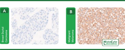 Histocyte Braf Analyte Control Ihc Abacus Dx