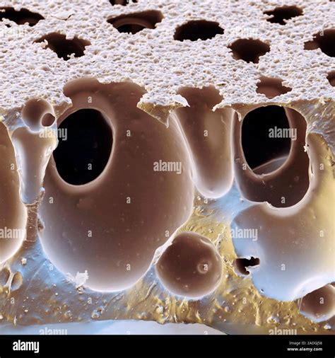 Wound Dressing Coloured Scanning Electron Micrograph Sem Of