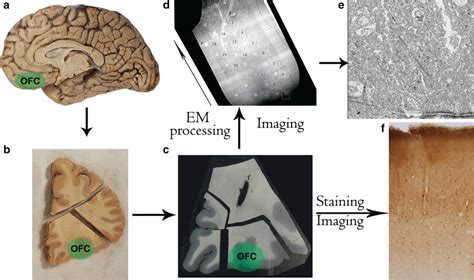 Experiment Design A B Blocks Of Post Fixed Post Mortem Brain Tissue Download Scientific