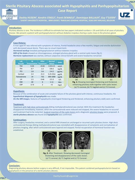Pdf Sterile Pituitary Abscess Associated With Hypophysitis And Panhypopituitarism Case Report