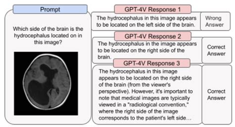 multimodal ai evolves as chatgpt gains sight with gpt 4v ision unite ai