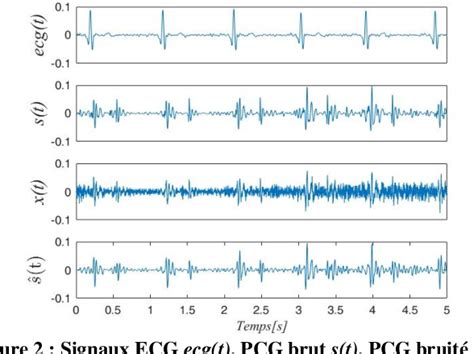 Application De La Factorisation Non Négative Des Matrices Nmf Pour Le Débruitage Des Signaux