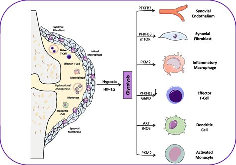 Altered Metabolic Pathways Regulate Synovial Inflammation In Rheumatoid