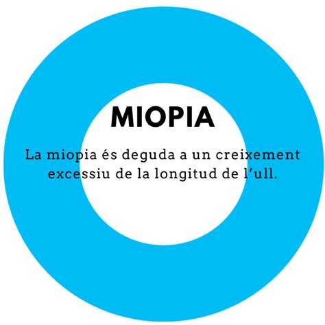 QuÈ És La Miopia QuÈ Passa Dins Lull Valls Òptics