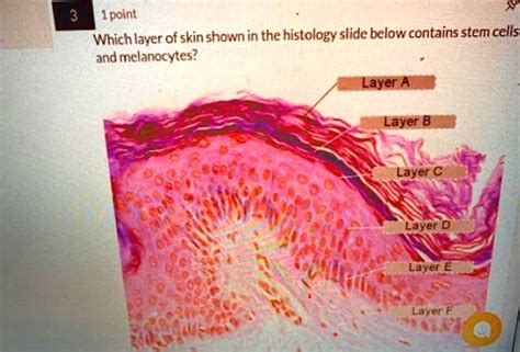 Which Layer Of Skin Shown In The Histology Slide Below Contains Stem