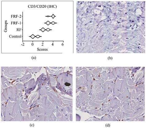 Analysis Of Lymphocyte Expression Cd3 Cd20 And Nk Cd57 A Scores