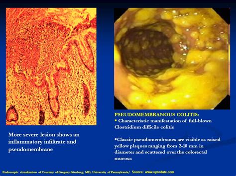 Senior Research Project Ppt Video Online Download