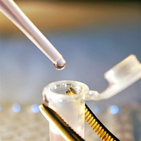 Stem Cell PRP Chicago Call Us At