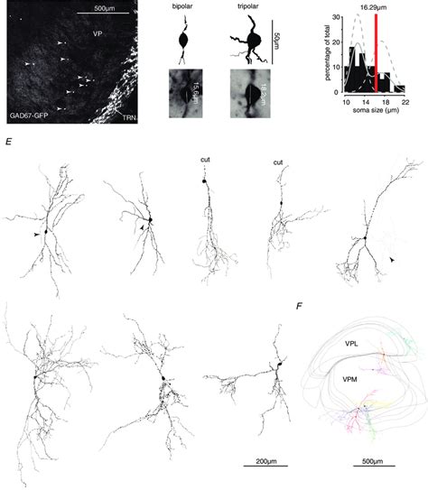 Morphology Of Vp Interneurons A Maximum Projection Of Z Stack Images