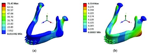 Distribution Of A Von Mises Stresses In Mpa And B Total Download Scientific Diagram