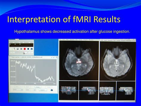 Ppt Daily Fmri Practice Powerpoint Presentation Free Download Id 3625546